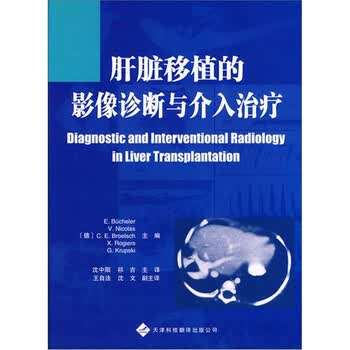  肝脏移植的影像诊断与介入治疗9787543323100