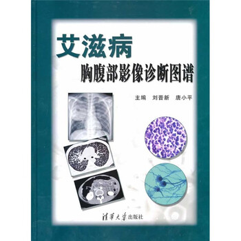 艾滋病胸腹部影像诊断图谱9787302233275清华大学