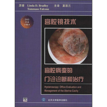 宫腔镜技术：宫腔病变的门诊诊断和治疗