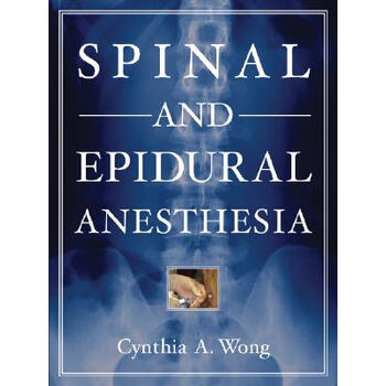 【】SPINAL AND EPIDURAL ANESTHESIA
