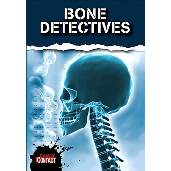 【】Bone Detectives