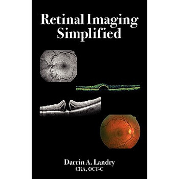 【】Retinal Imaging Simplified