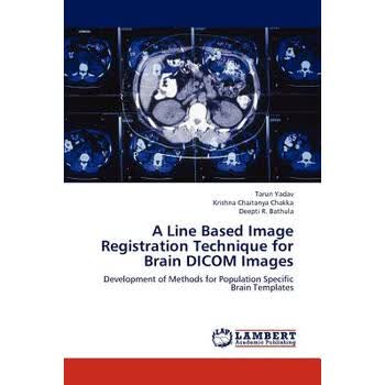【】A Line Based Image Registratio
