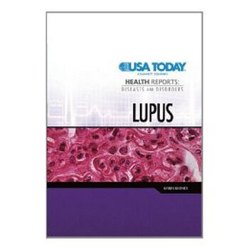 【】Lupus