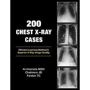 【】200 Chest X-Ray Cases