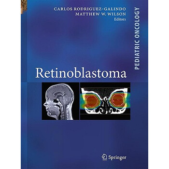【】Retinoblastoma