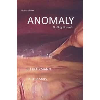 【】Anomaly: Finding Normal