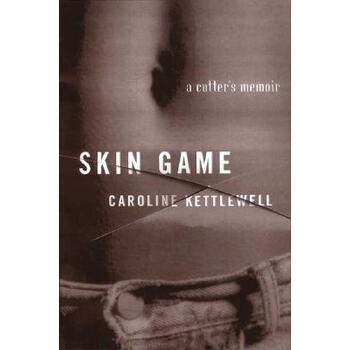 【】Skin Game: A Memoir