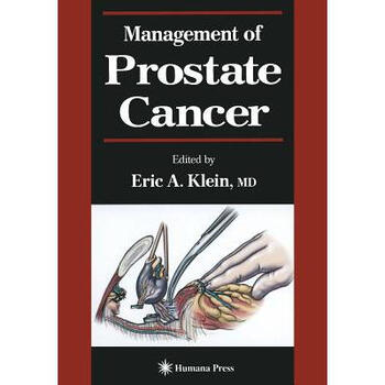 Management of Prostate Cancer