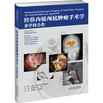经鼻内窥镜颅底肿瘤手术学 多学科合作