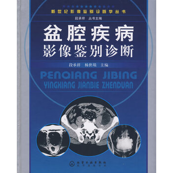 盆腔疾病影像鉴别诊断 段承祥,杨志埙 化学工业出版社