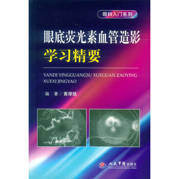 眼底荧光素血管造影学习精要-眼科入门系列