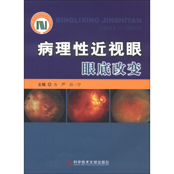 病理性近视眼眼底改