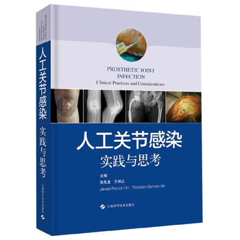 人工关节感染(实践与思考)(精)