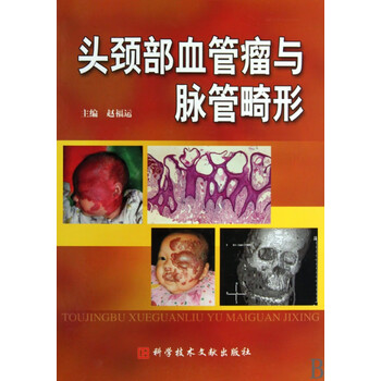 头颈部血管瘤与脉管畸形(精)