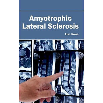 Amyotrophic Lateral Sclerosis