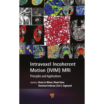 Intravoxel Incoherent Motion (IVIM) MRI: Princip