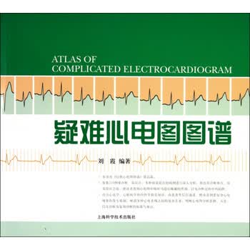疑难心电图图谱