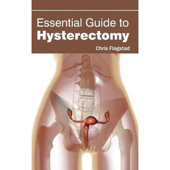 Essential Guide to Hysterectomy