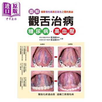 观舌治病 糖尿病 高血压：揭开慢性病与舌气色之间的奥秘 港台原版 蔡鸿祺 蔡淑雅 康鉴文化