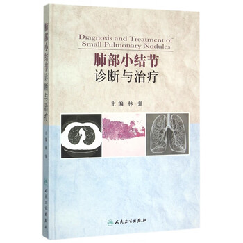 肺部小结节诊断与治疗(精)