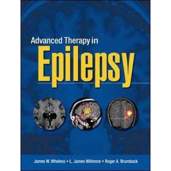Advanced Therapy in Epilepsy