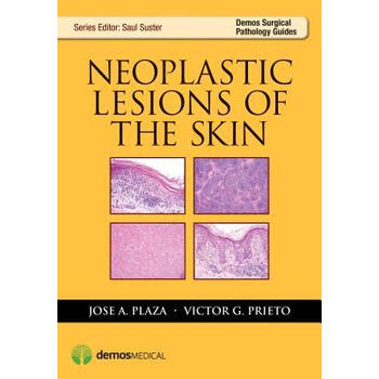 Neoplastic Lesions of the Skin