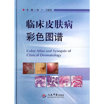 临床皮肤病彩色图谱 赵广【正版书】