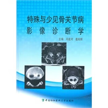 特殊与少见骨关节病影像诊断学