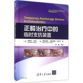 正畸治疗中的临时支抗装置