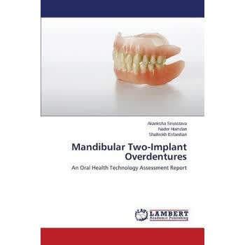Mandibular Two-Implant Overdentures