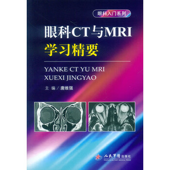 眼科CT与MRI学习精要 唐维强 人民军医出版社