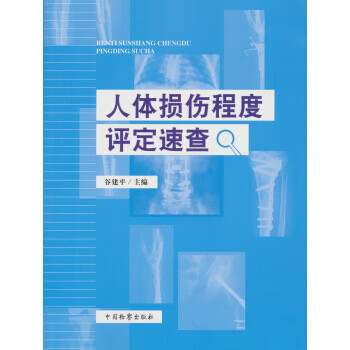 保证正版 人体损伤程度评定速查 谷建平 中国检察出版社 9787510213335