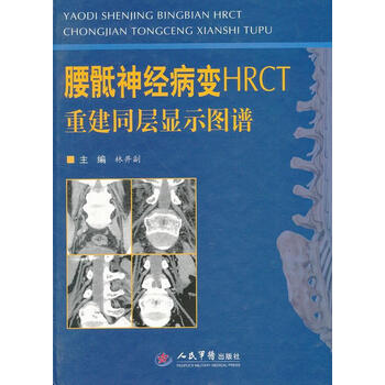 腰骶变HRCT重建同层显示图谱【正版图书】