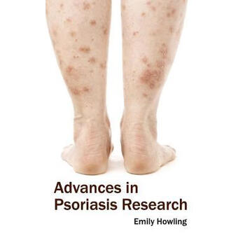 Advances in Psoriasis Research