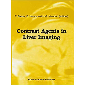 Contrast Agents in Liver Imaging