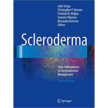 Scleroderma: From Pathogenesis to Comprehensive