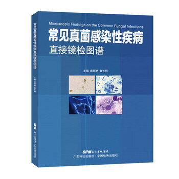常见真菌感染性疾病直接镜检图谱 席丽艳 鲁长明 主编 针对当前临床真菌实验室检查具体情况编撰 广东