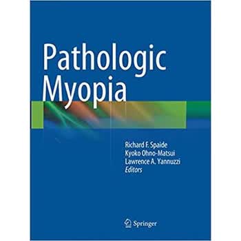 高被引Pathologic Myopia