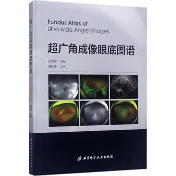 超广角成像眼底图谱 张贵森 著【正版书】