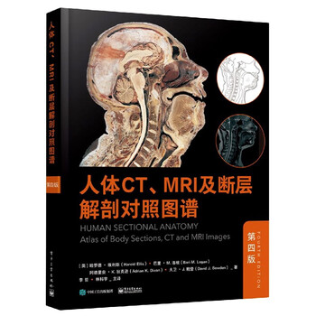 人体CT\MRI及断层解剖对照图谱(第4版)(精)
