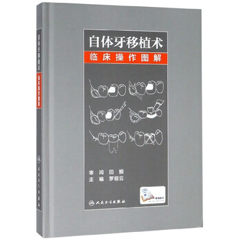 自体牙移植术临床操作图解(精)