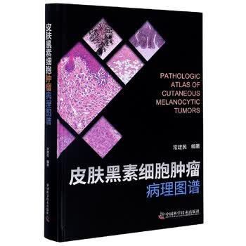 皮肤黑素细胞肿瘤病理图谱(精)