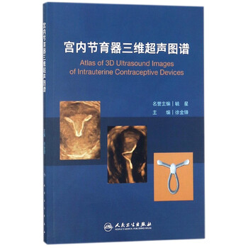 宫内节育器三维超声图谱