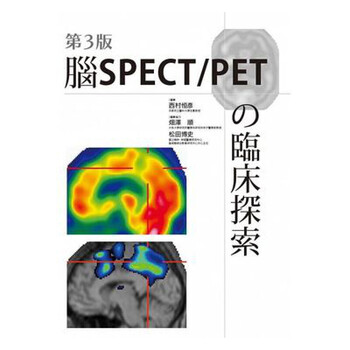 台版 脑SPECT PET临床探索 第3版脑核医学检查临床应用理论大脑疾病医疗