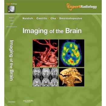 Imaging of the Brain: Expert Radiology Series