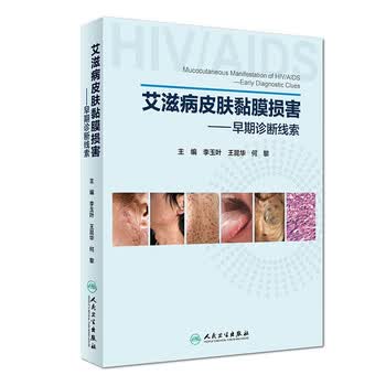 艾滋病皮肤黏膜损害——早期诊断线索