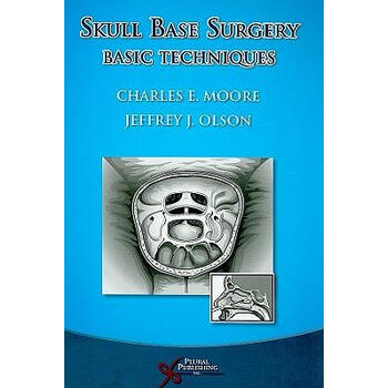 Skull Base Surgery