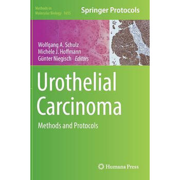 Urothelial Carcinoma: Methods and Protocols
