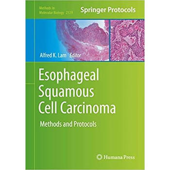 Esophageal Squamous Cell Carcinoma: Methods and